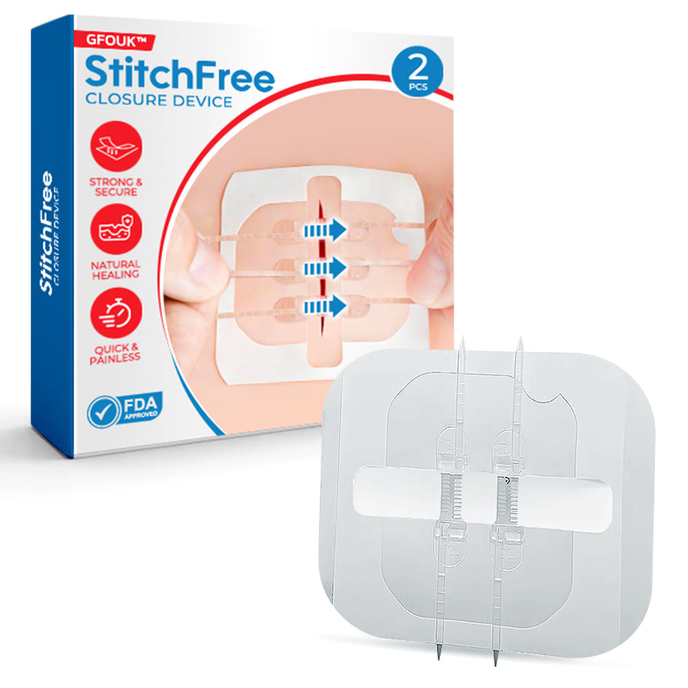 GFOUK™ StitchFree Closure Device – G-FOUK