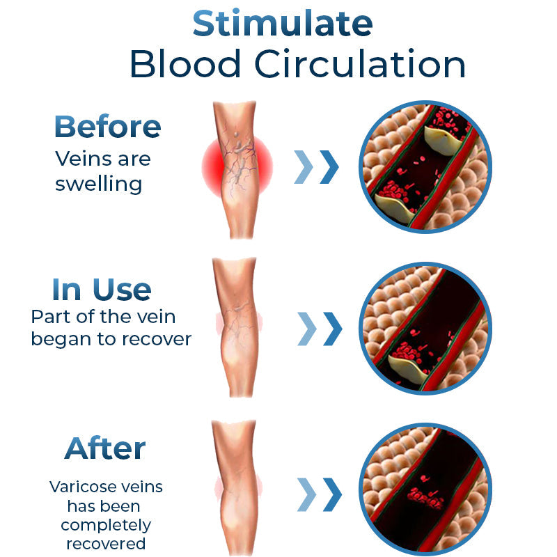 GFOUK™ Mucopolysaccharide Polysulfate Cream – G-FOUK