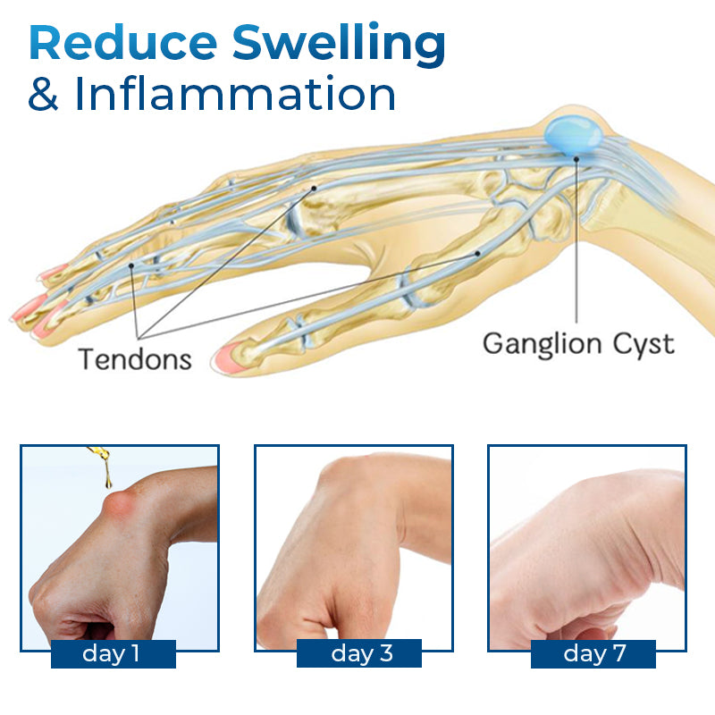 GFOUK™ German Wrist Tendonitis Therapy Oil – G-FOUK