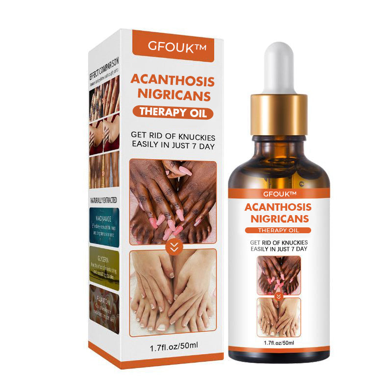 GFOUK™ Acanthosis Nigricans Therapy Oil – G-FOUK